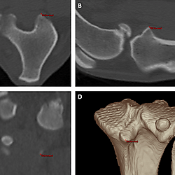 Image_1_Three-dimensional computed tomographic angular measurements of the canine tibia using a ...