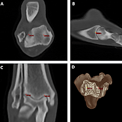Image_7_Three-dimensional computed tomographic angular measurements of the canine tibia using a ...