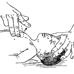 Chest compressions to an infant