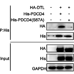 Additional file 3: of DTL promotes cancer progression by PDCD4 ...