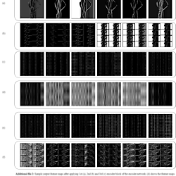 Additional file 3 of SpikeSegNet-a deep learning approach utilizing encoder-decoder network with ...