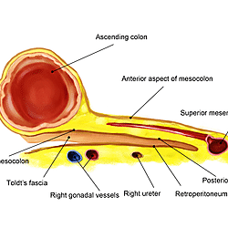 Laparoscopic Complete Mesocolic Excision With Central, 48% OFF