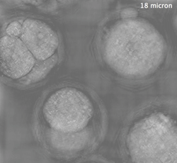Item - Visualization 1: 3D differential phase contrast microscopy ...
