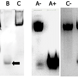 A: Immunoblot of a native PAGE gel.