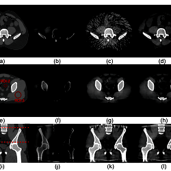 Edge effect: Two transverse slices (in the top and middle row) and one ...