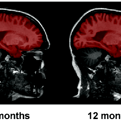 Demonstration of 4D brain extraction and cerebellum removal on four ...