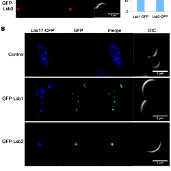 Lsb1 and Lsb2 colocalize with Las17.