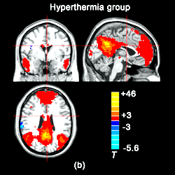 Maps of brain regions showing significant positive or negative ...