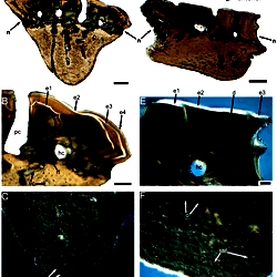 Scales (subtypes 2 and 4) of Psarolepis romeri.