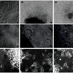 Effect of Ca2+-ICR exposure on NT2 cell morphology by phase contrast ...
