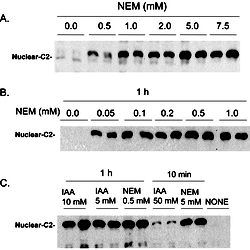 Effect of NEM and IAA concentrations on endogenous nuclear caspase-2 ...