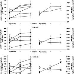 SEP signals during different conditions.