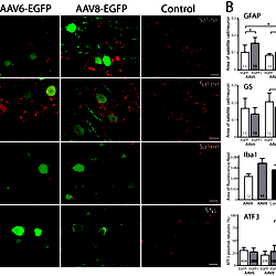 Identification of inflammatory response and neurotoxicity in AAV ...