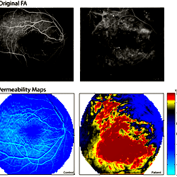 Generation of permeability maps.