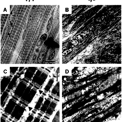 Representative electron micrographs of extensor digitorum longus (EDL ...
