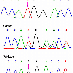 Identification of the causative mutation in EDA gene.