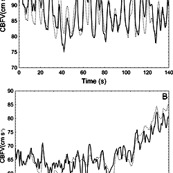 Comparison of the actual and predicted CBFV signals.