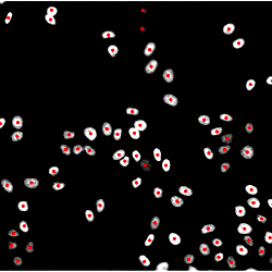 An example of blob-structure (HeLa cell nuclei) detection.