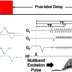 MBME ASL/BOLD pulse sequence design.