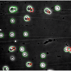 Digital phase-contrast picture of yeast cells.