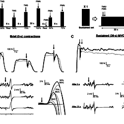 Schematic description of the neuromuscular assessment procedure which ...