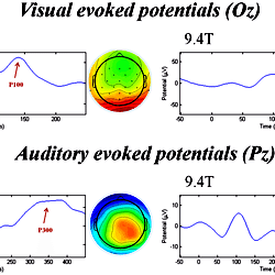 Example of (a) visual evoked P100 and (b) auditory P300 (target stimuli) at 0T and 9.4T at IC ...