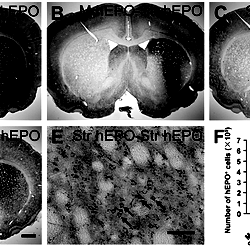 Transgene (human erythropoietin, hEPO) expression in the rat brain ...