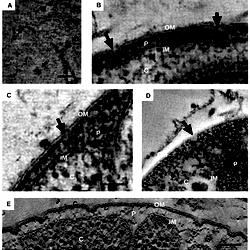 Crateriform structures.