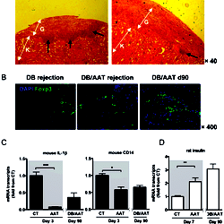 AAT treatment combined with debulking therapy; histology and gene ...