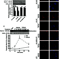 Effect of clathrin-shRNA on Necl-2 protein level and endocytosis assay.