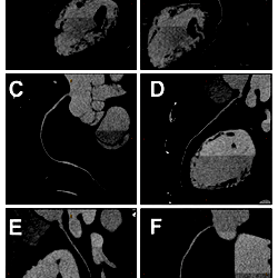 Representative CCTA demonstrating image quality with different scan ...