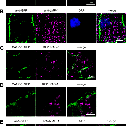 Subcellular localization of CATP-6 in the spermatheca.
