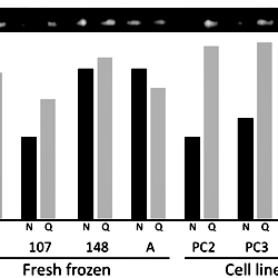 Significant discrepancies in DNA quantification by NanoDrop and Qubit.