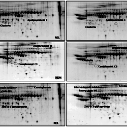 2D protein expression maps.