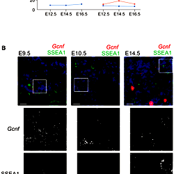 Gcnf expression in fetal ovarian germ cells.