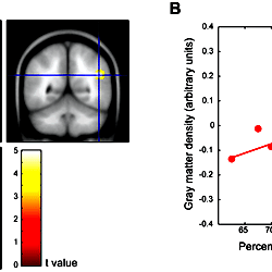 VBM analysis.