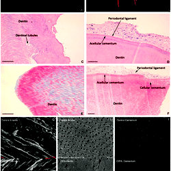 Pathological examination of the patient's exfoliated primary tooth.