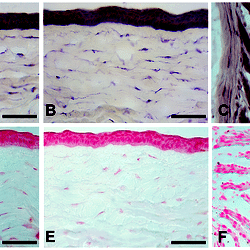 Representative alizarin red (A-C) and vonKossa (D-F) staining in rabbit ...