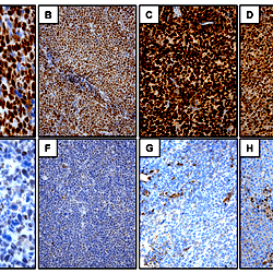 Validation of IHC staining of NICD1 using formalin FPE tumor xenografts.