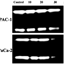 The gelatinase activity alterations of MMP-2/9 in both cells were ...