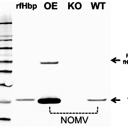 Detection of fHbp in NOMV vaccines by Western blot using anti-fHbp mAb ...