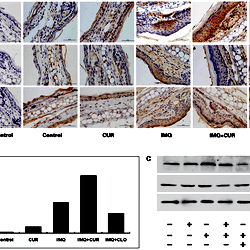 Immunohistochemical staining for TCR γδ, CCR6 and RORγ in skin.