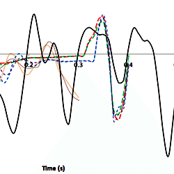 Temporal waveforms of the intraventricular pressure difference (IVPD ...