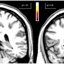 Multi-task analysis Complex Scale vs Simple Scale.