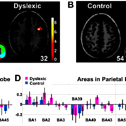 Activations in fronto-parietal regions.
