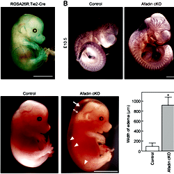 Severe subcutaneous edema in afadin cKO mice during embryogenesis.