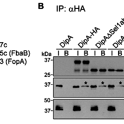 Identification of DipA interacting partners.
