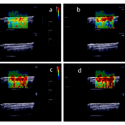Changes of shear elastic modulus of pig patella tendon (PT) during ...