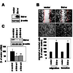 Bcl-w enhances migration and invasion in U251 glioblastoma cells.