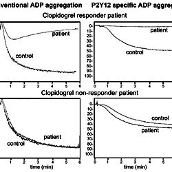 Representative ADP aggregation curves demonstrating the effect of ...
